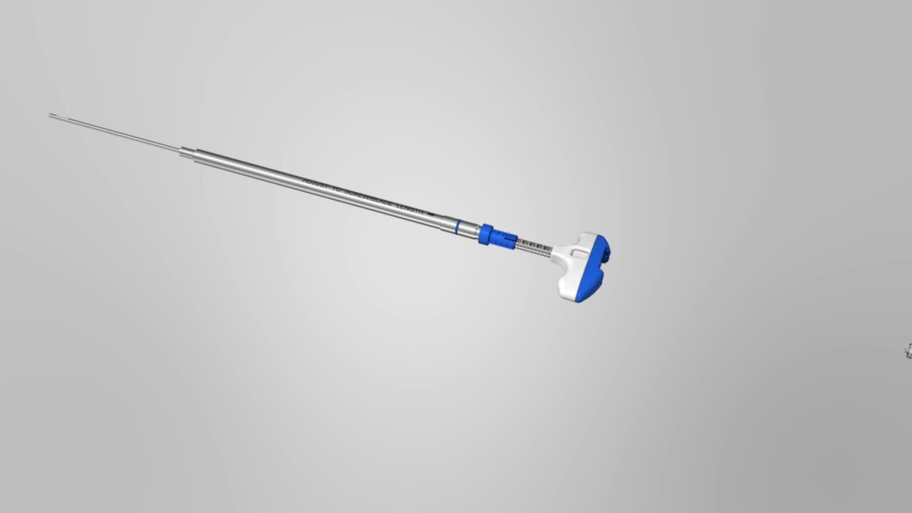 TRAUMACEM™ V+ Augmentation System | DePuy Synthes