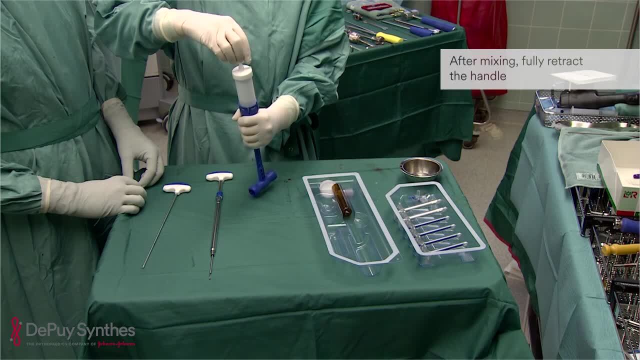 TRAUMACEM™ V+ Augmentation System | DePuy Synthes
