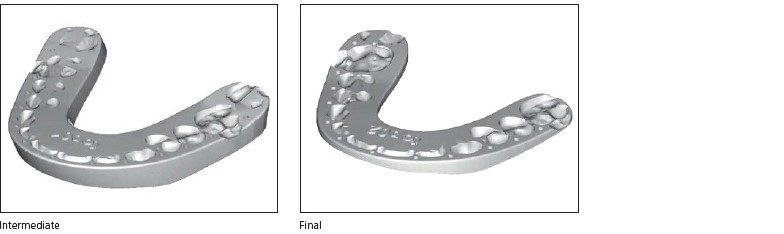 Orthognathic Splints & Wafers | DePuy Synthes