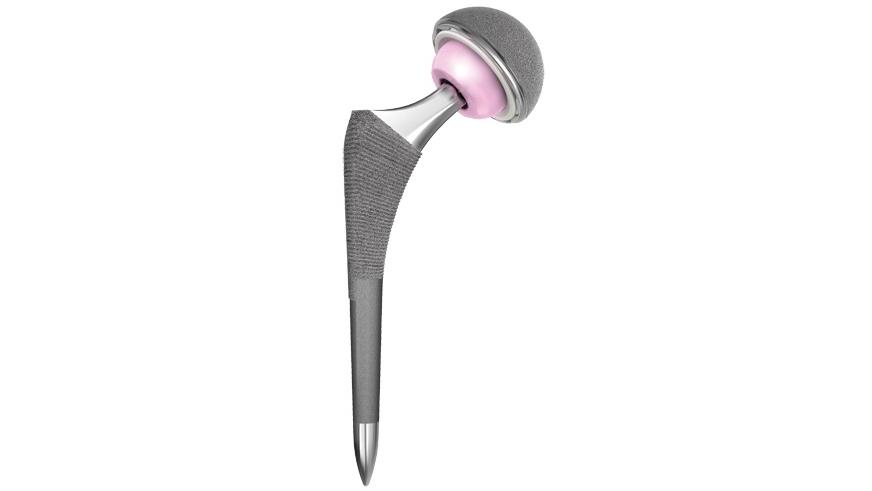 Hip Images | Patient Education Resource | DePuy Synthes