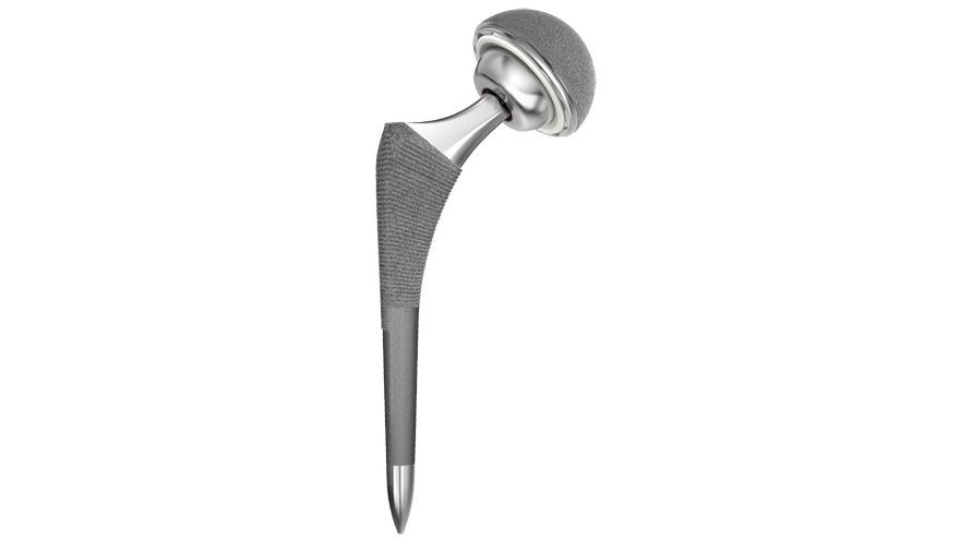 Hip Images | Patient Education Resource | DePuy Synthes