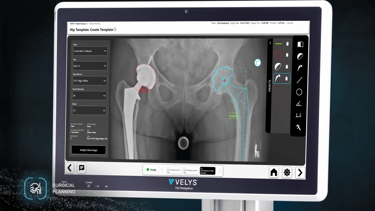 VELYS™ Hip Navigation Resource Packet | DePuy Synthes