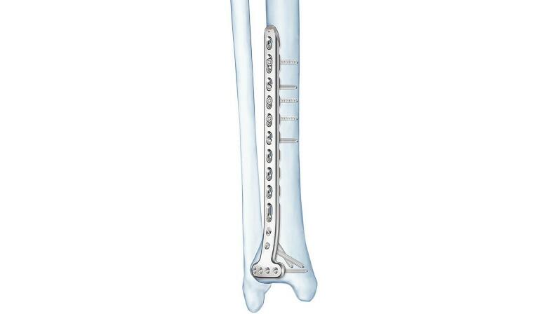 Foot & Ankle | DePuy Synthes
