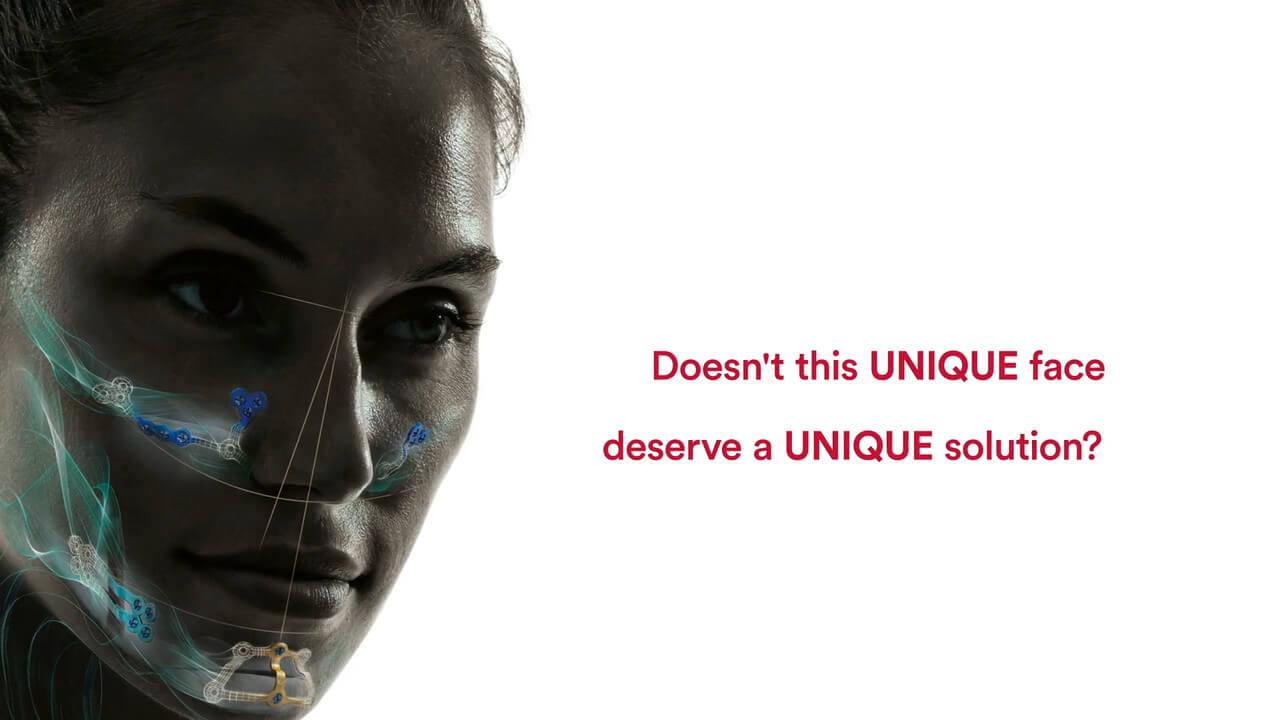 TRUMATCH™ CMF Personalized Solutions | DePuy Synthes