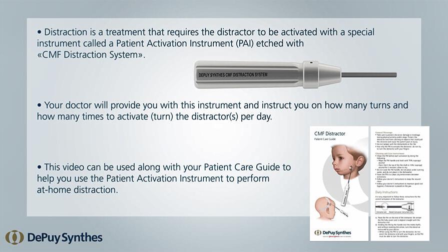 Craniomaxillofacial Distraction (CMFD) System | Products | DePuy Synthes