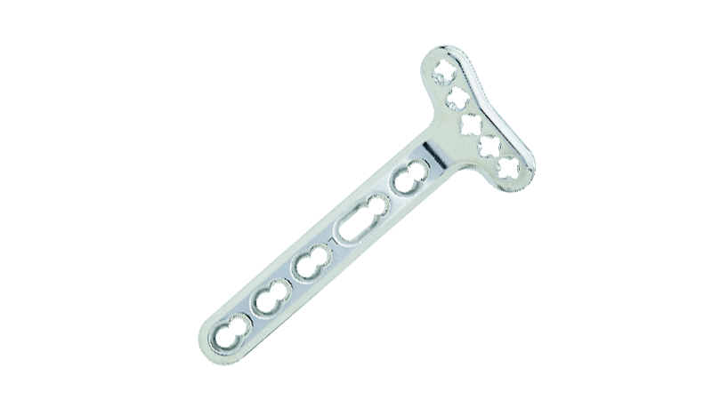 2.4 mm Variable Angle LCP™ Volar Extra-Articular Distal Radius System ...