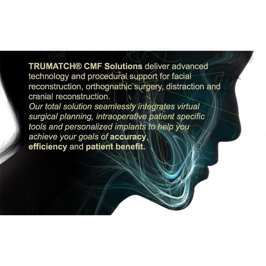TRUMATCH® CMF Personalized Solutions | DePuy Synthes